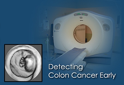 New ACS Guidelines for Colorectal Cancer Screening: Start Earlier ...